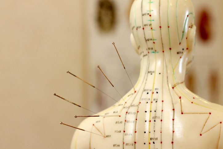 Common Facts about Acupuncture - Indoindians.com