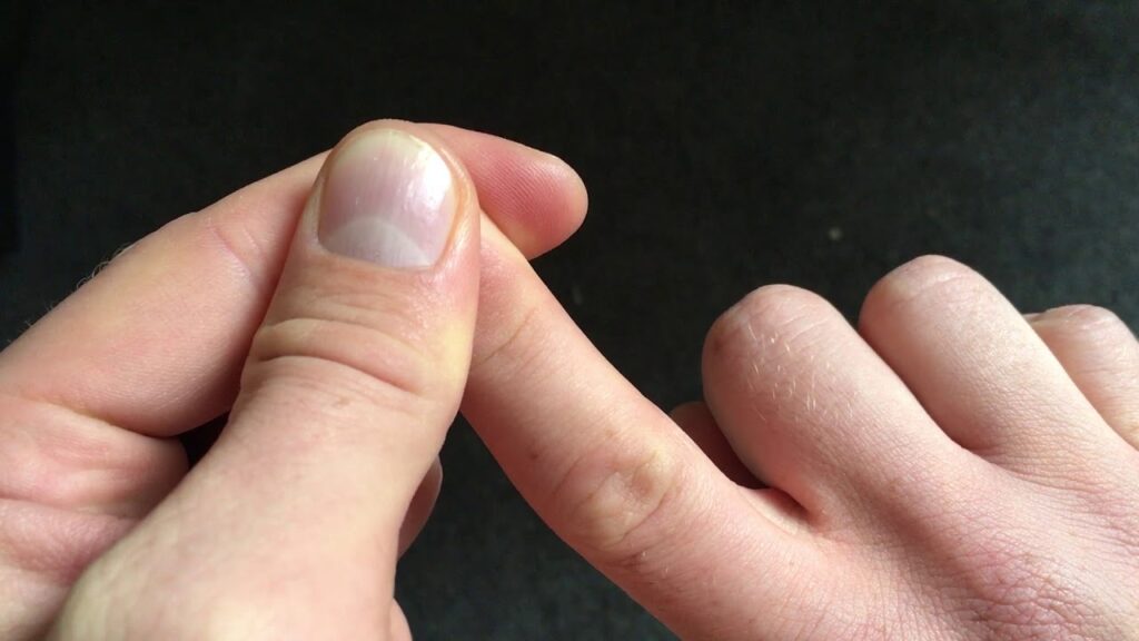 Dehydration Symptoms and Tests - Indoindians.com